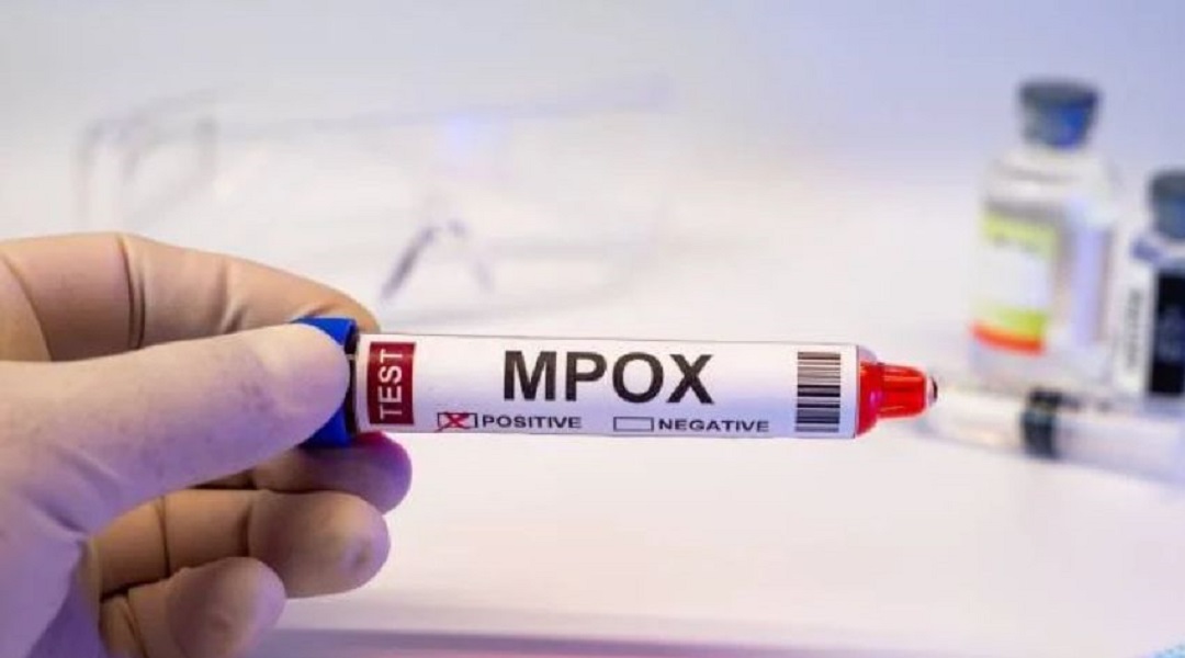 Mpox On The Move: What You Need To Know To Stay Safe - African ...